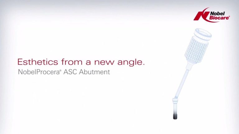 Nobel ASC Abutments Changing Dentistry - Peterson Dental Laboratory