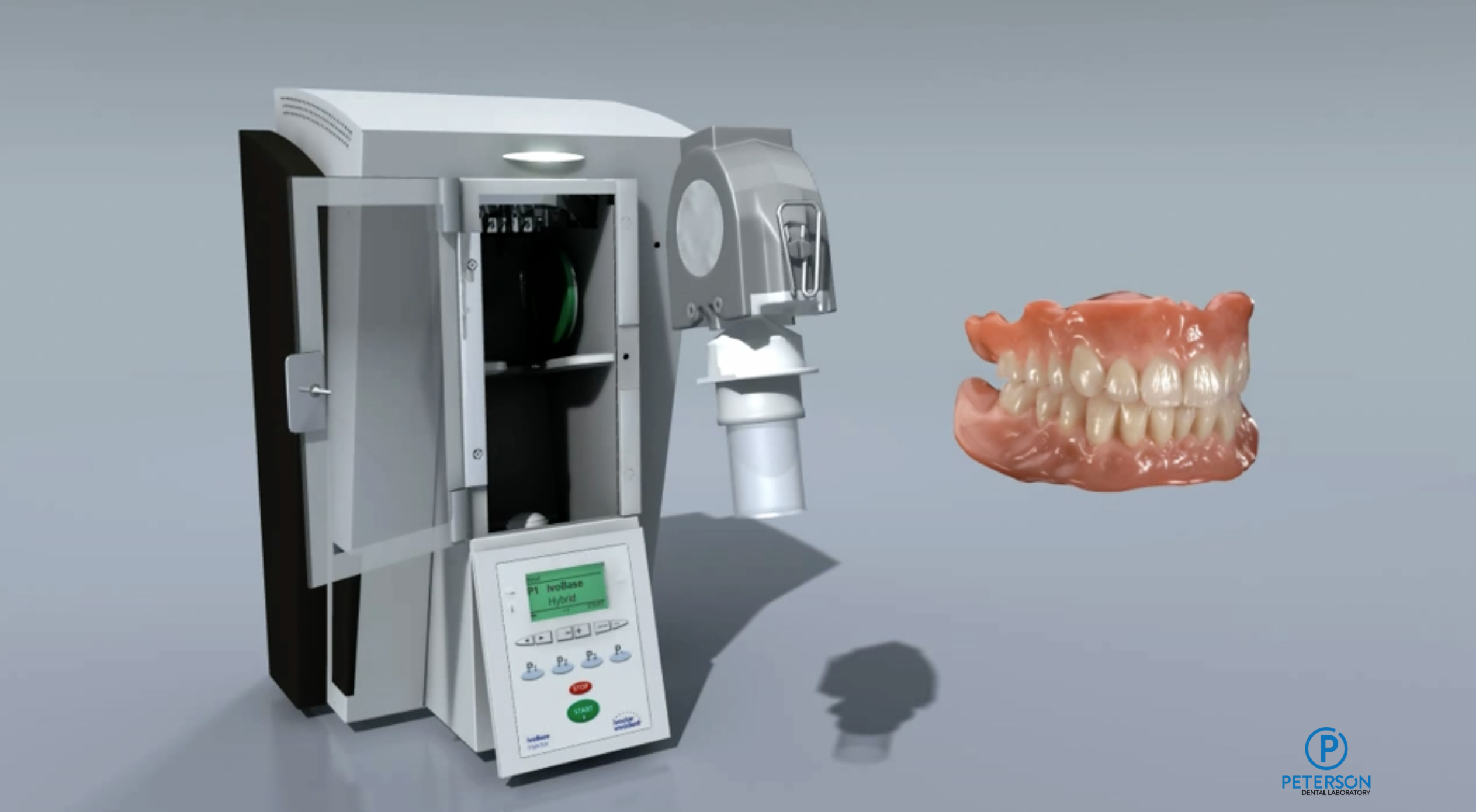 Why do Hybrids Break? Part 1 - Peterson Dental Laboratory
