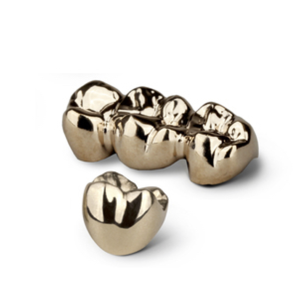 A Golden Touch for the Digital Age - Peterson Dental Laboratory