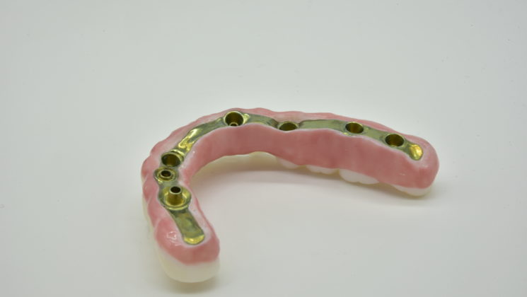 Products - Peterson Dental Laboratory