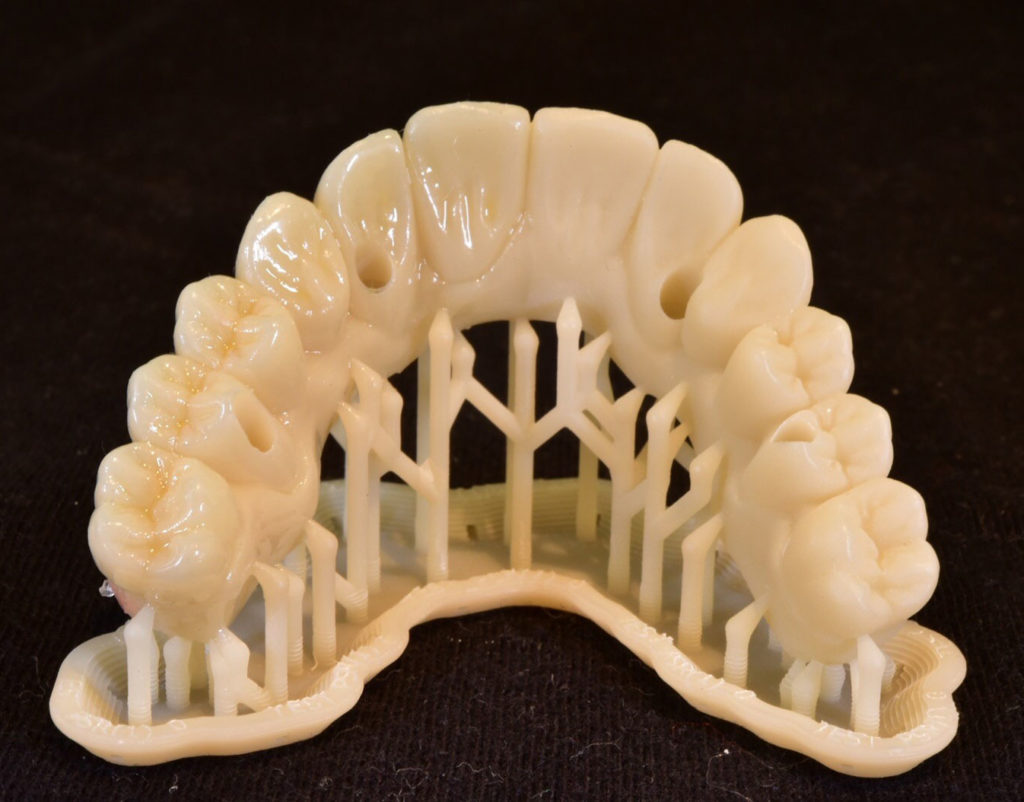 Getting Started with a Final Full Arch Solution - Peterson Dental Laboratory